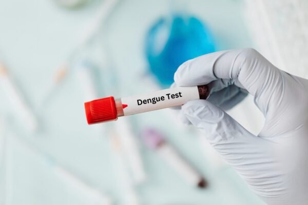 Everything you Need to Know About Dengue Blood Tests: Diagnosis ...