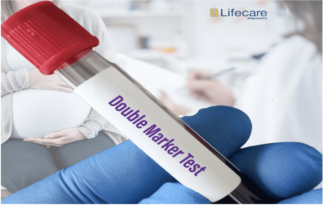 Double Marker Test - Lifecare Diagnostics
